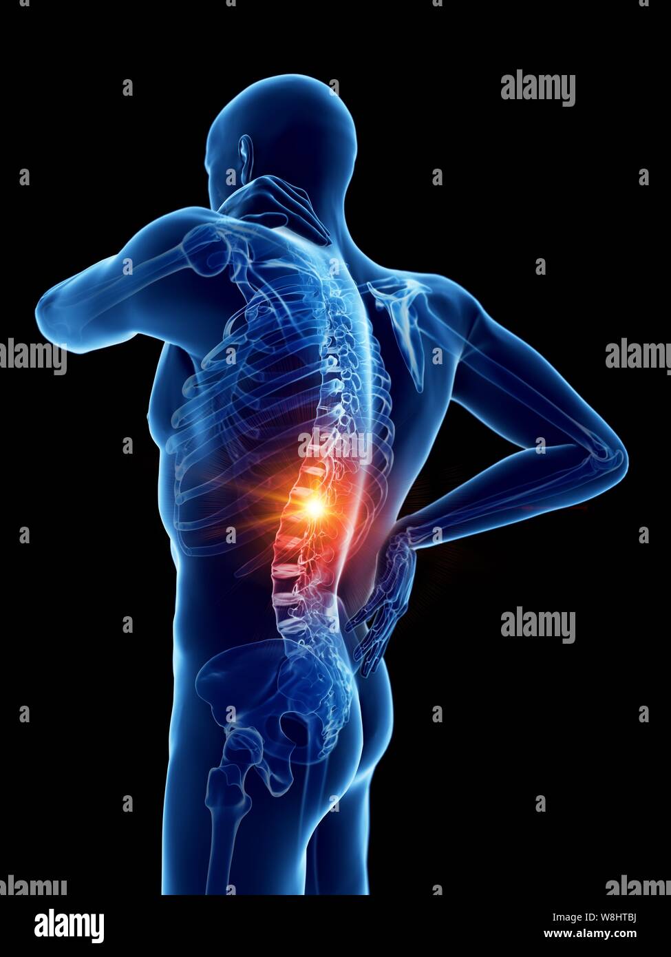 Back pain, computer illustration Stock Photo - Alamy