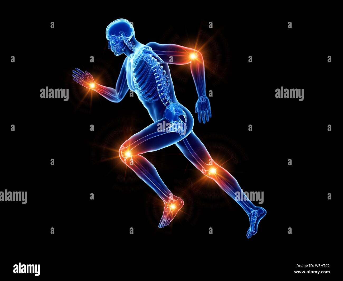 Runner with joint pain, conceptual computer illustration Stock Photo ...