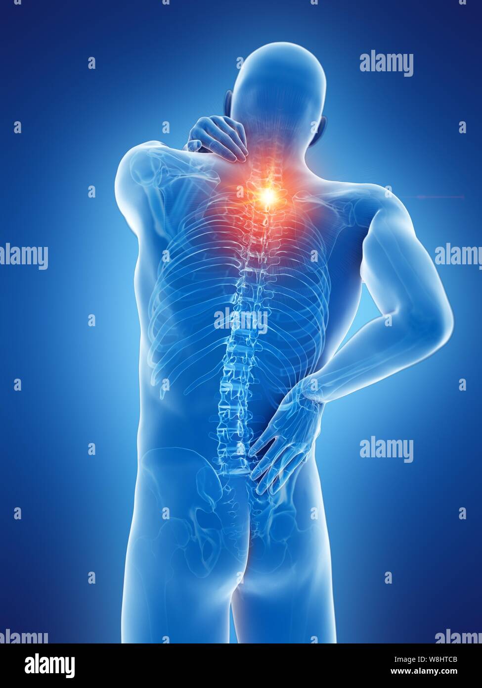 Back pain, computer illustration Stock Photo - Alamy
