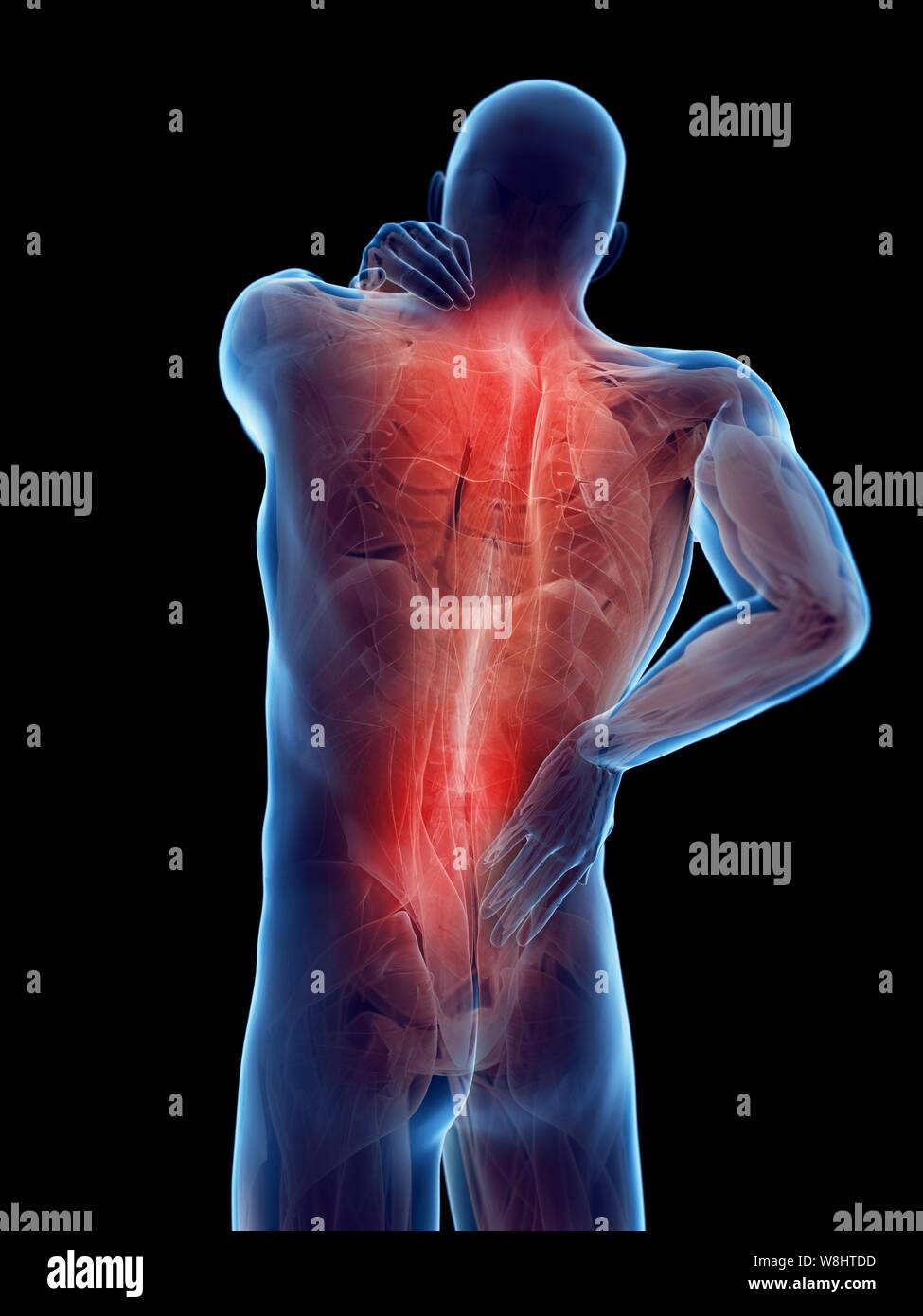 Back pain, computer illustration Stock Photo - Alamy