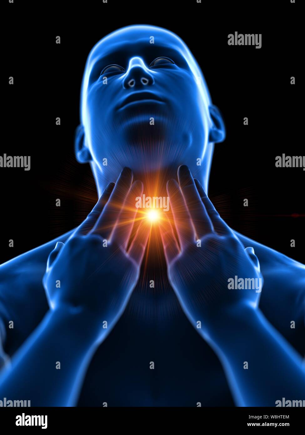 Sore throat, conceptual computer illustration Stock Photo - Alamy