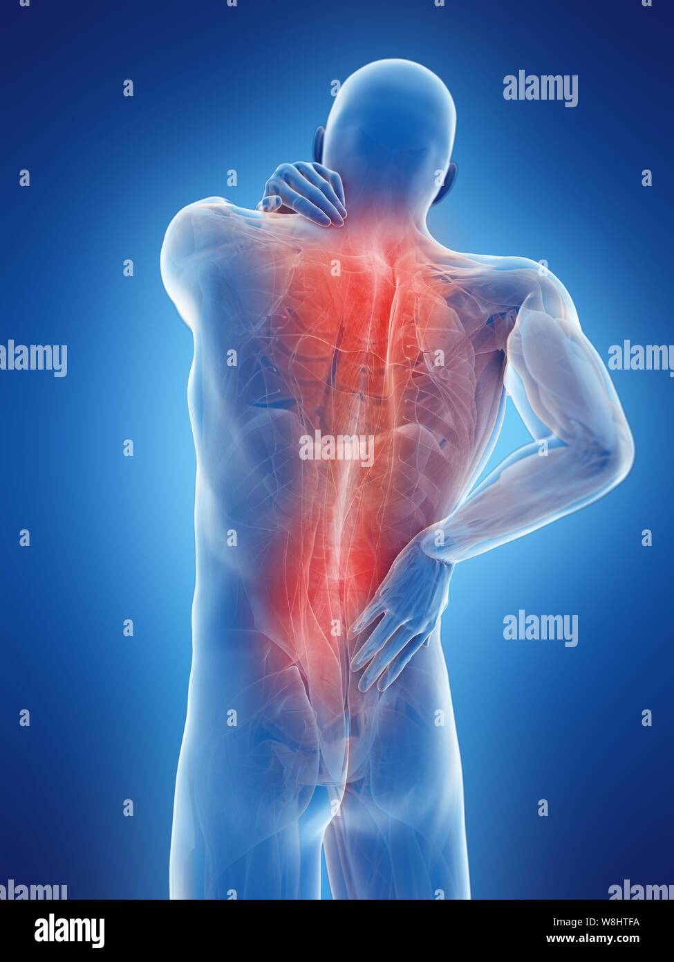 Back pain, computer illustration Stock Photo - Alamy