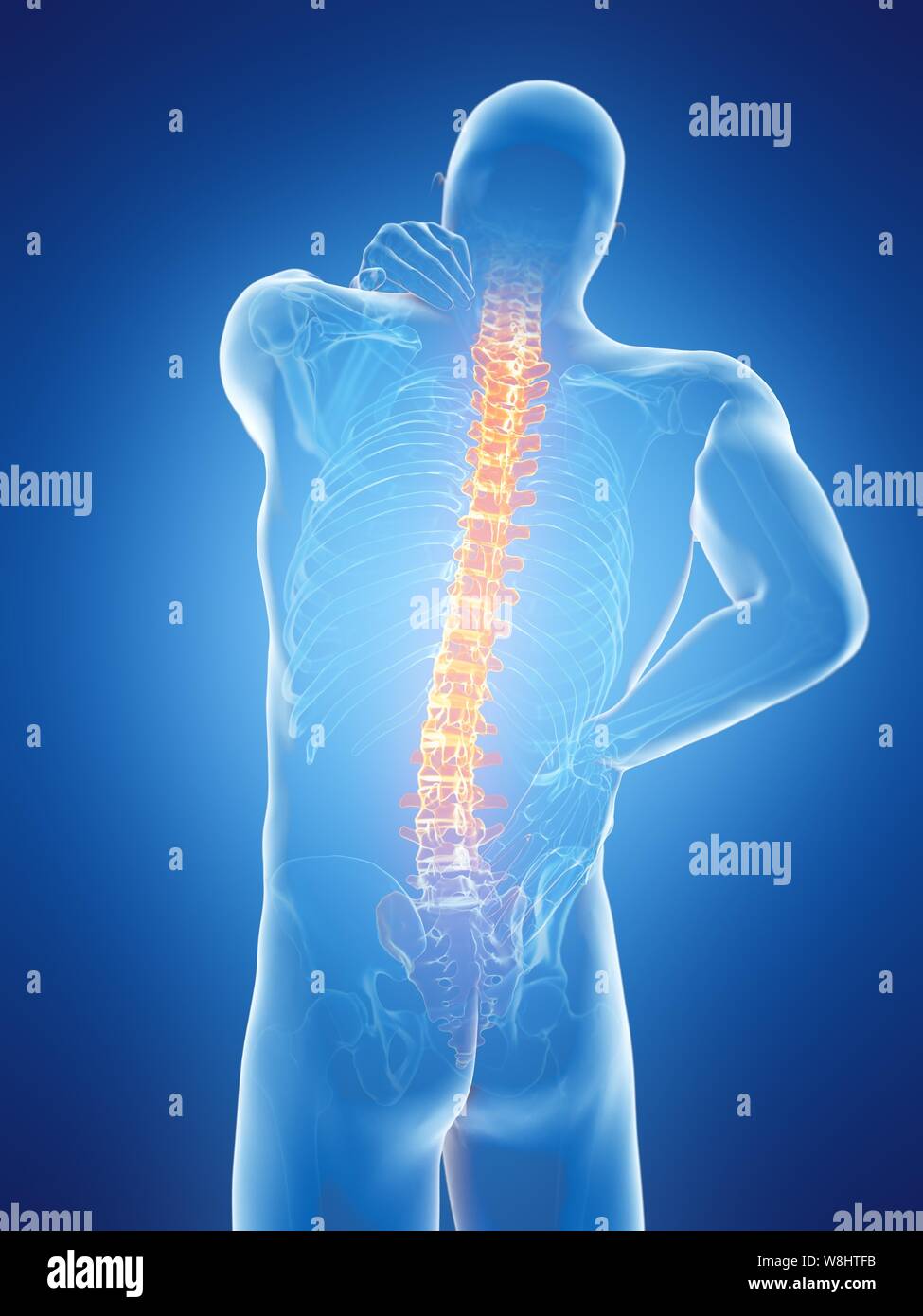 Back pain, computer illustration Stock Photo - Alamy