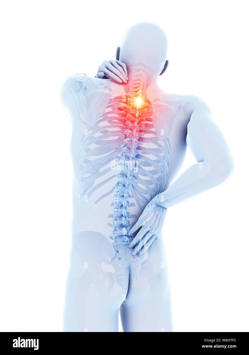Back pain, computer illustration Stock Photo - Alamy