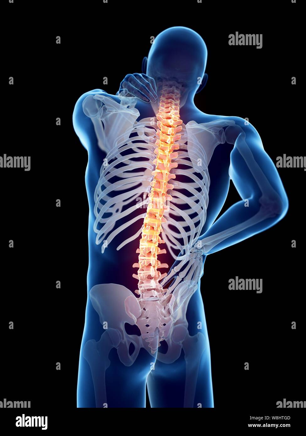Back pain, computer illustration Stock Photo - Alamy