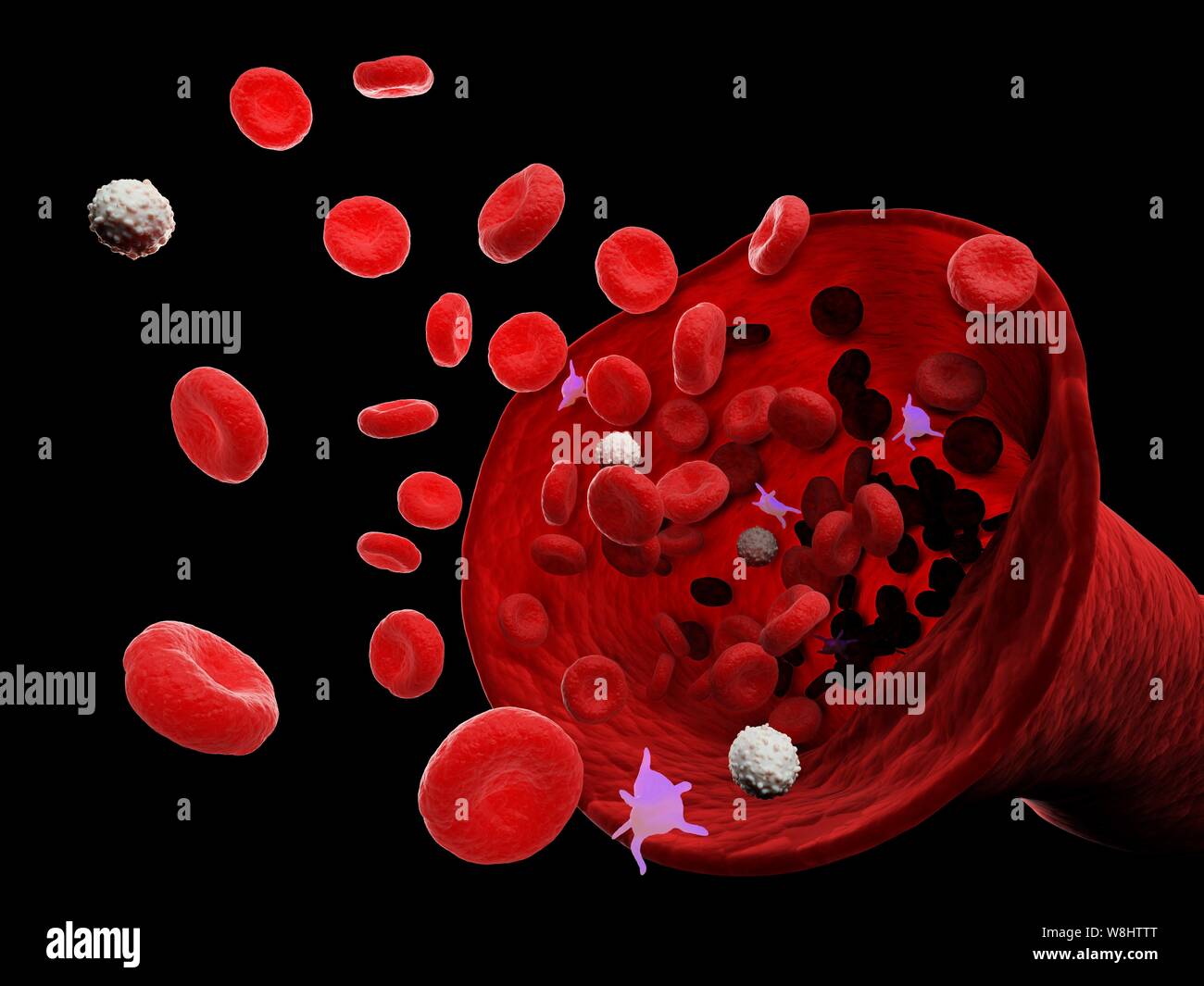 Blood vessel, computer illustration Stock Photo - Alamy