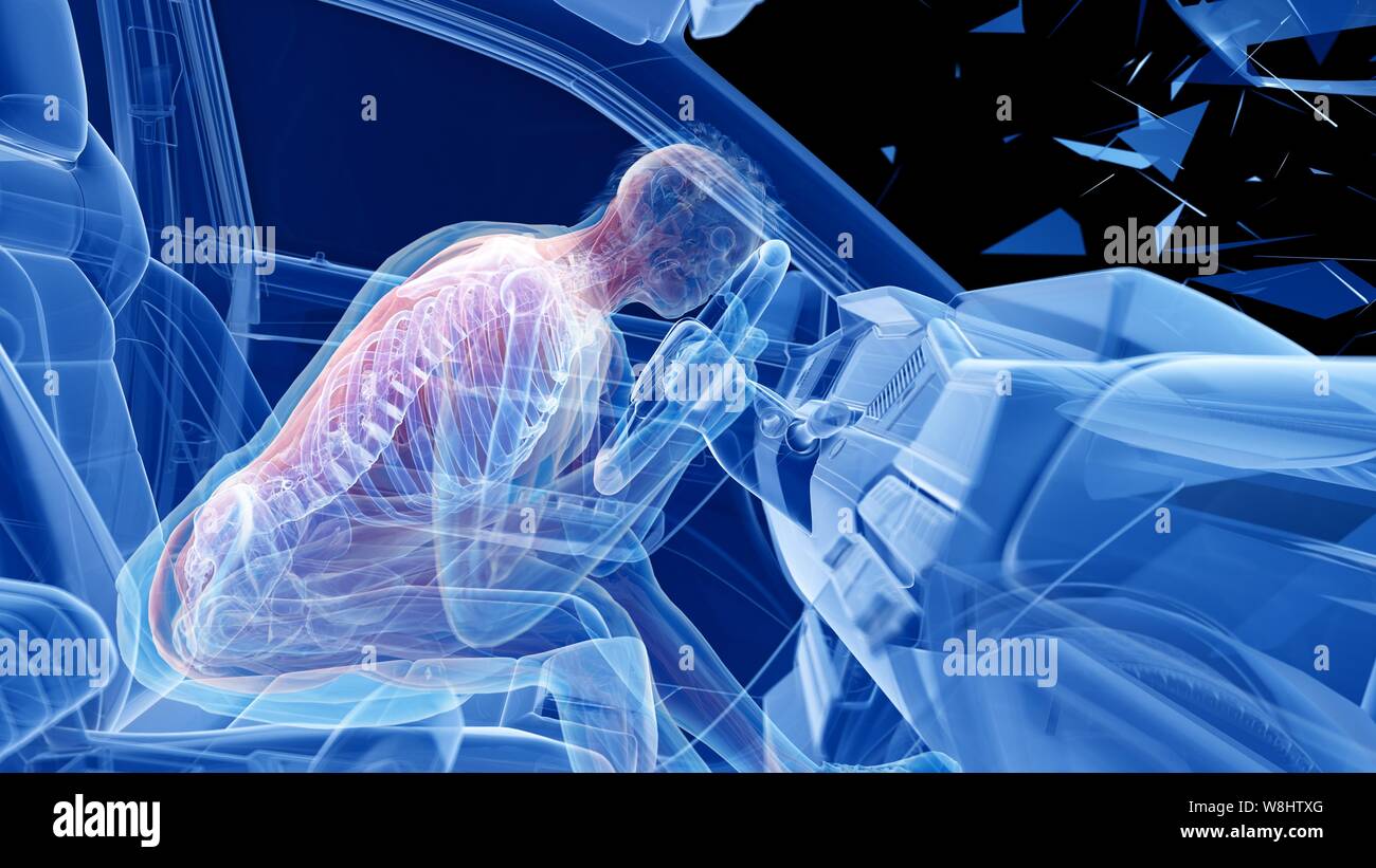 Car crash, computer illustration Stock Photo - Alamy