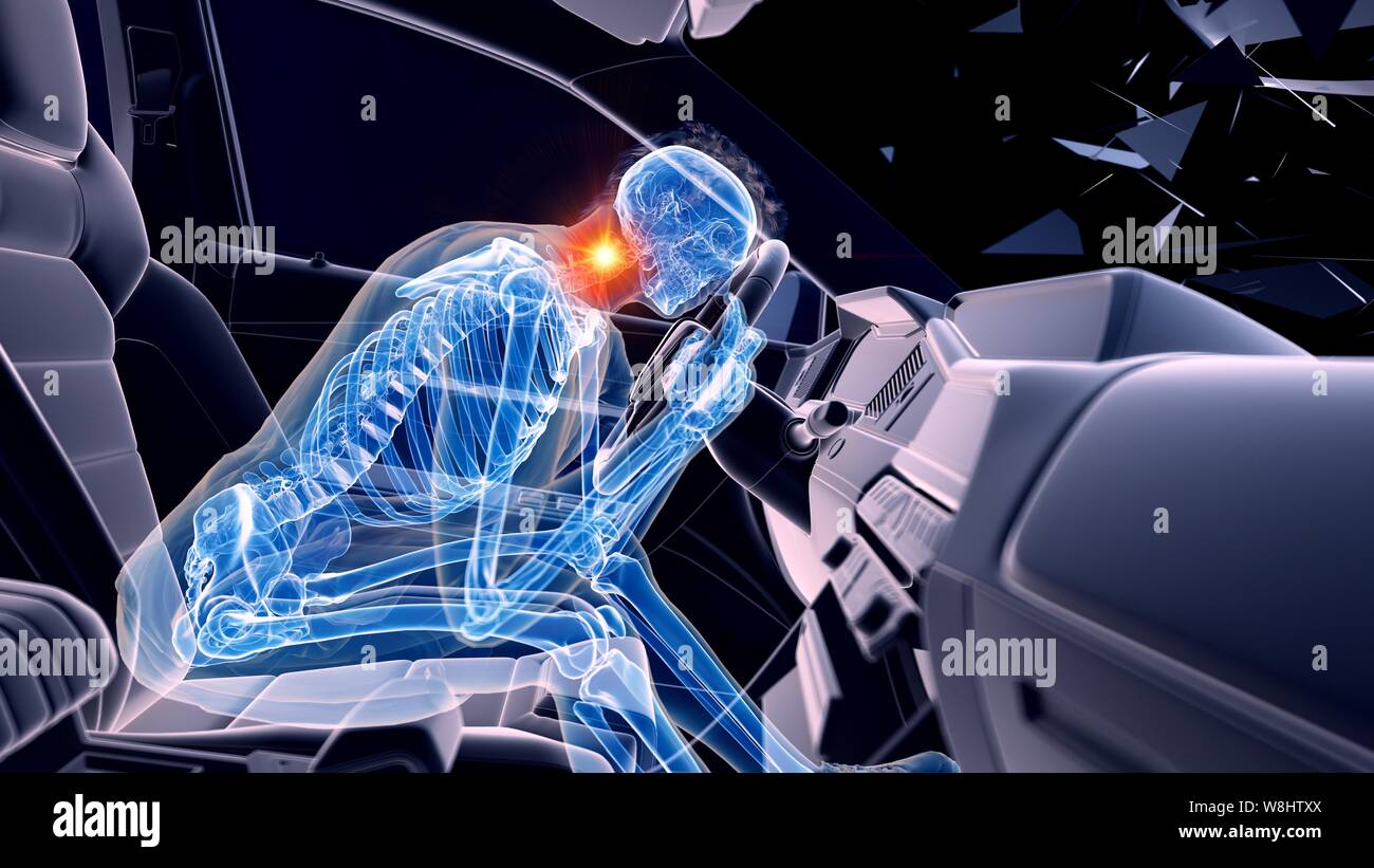 Car crash, computer illustration Stock Photo - Alamy