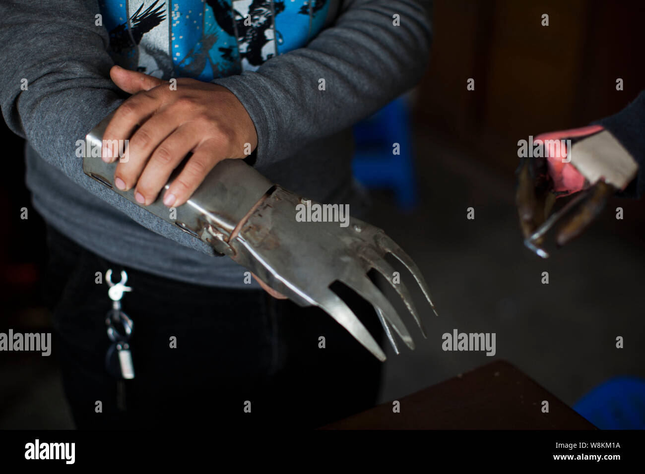 A Chinese villager who lost his right hand tries on a mechanical hand ...