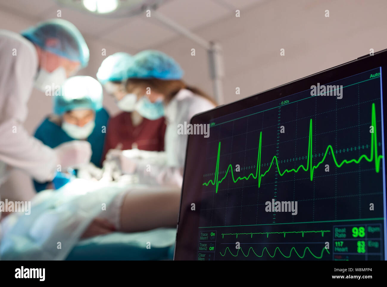 Monitoring of ECG and saturation O2 in the patient in the operating ...