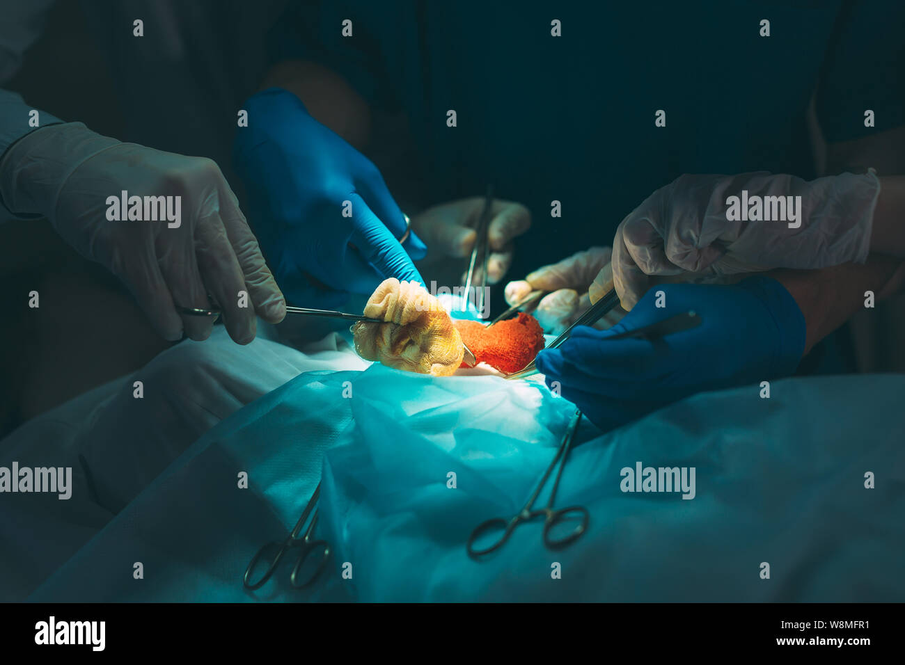 Close up detail of a surgery. Group of surgeons at work operating in ...