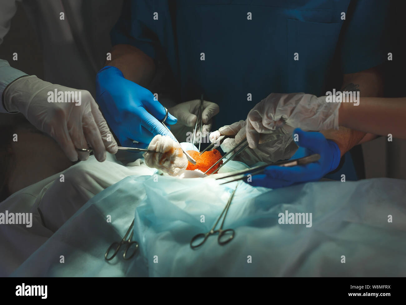 Close up detail of a surgery. Group of surgeons at work operating in ...