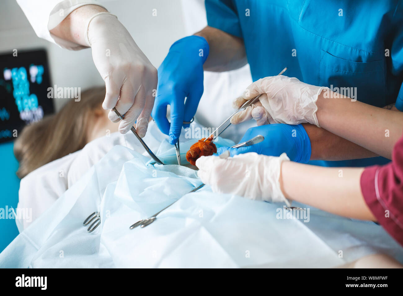 Close up detail of a surgery. Group of surgeons at work operating in ...