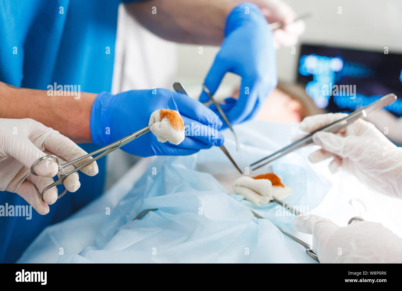 Close up detail of a surgery. Surgery and emergency concept Stock Photo ...