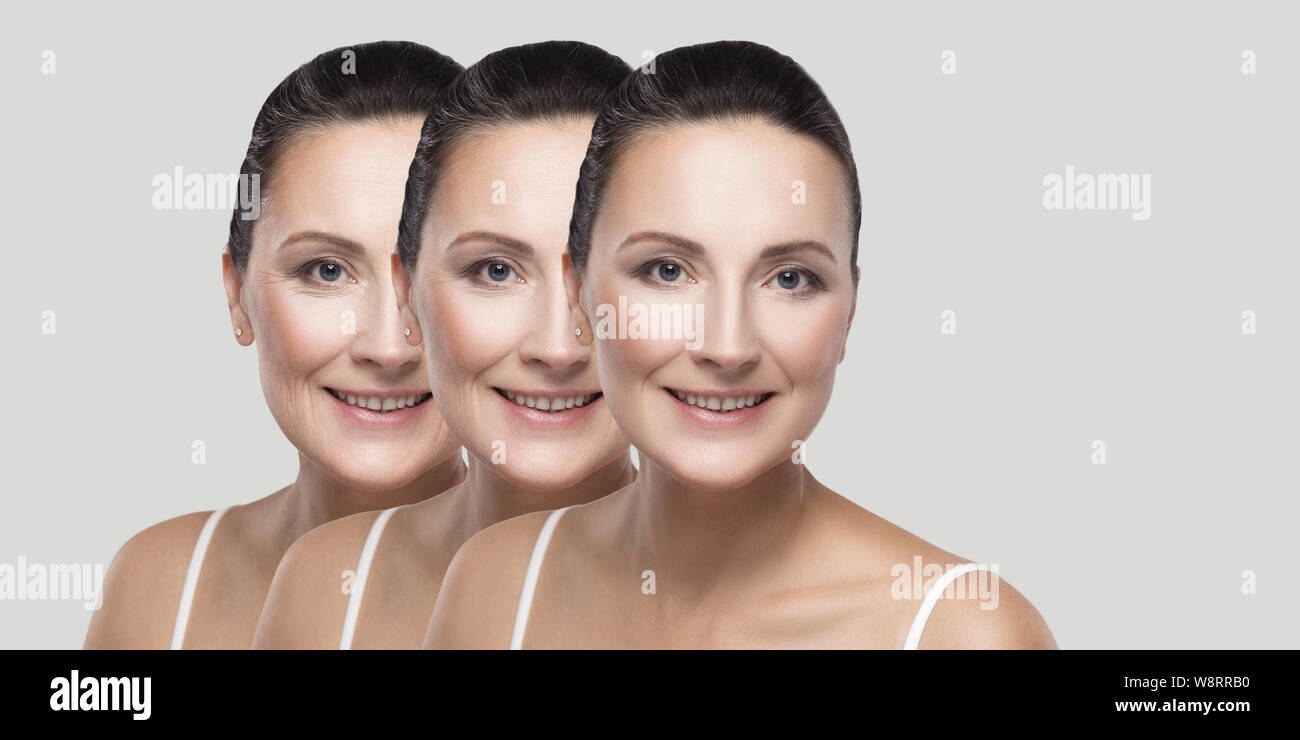 Before and after beauty skin wrinkles treatment procedure. Middle aged ...