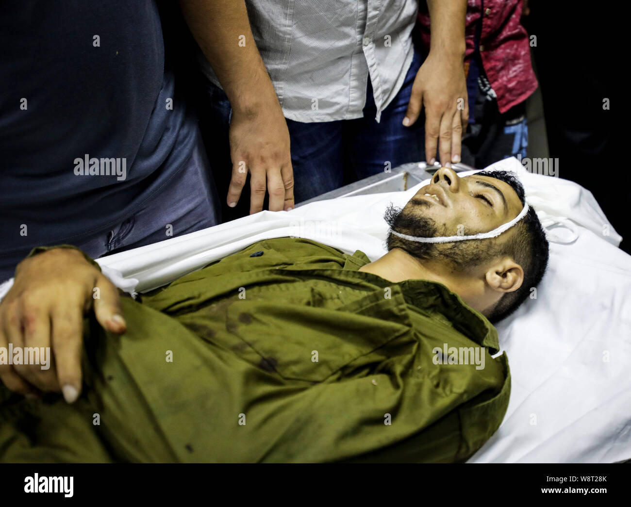 Cadaver Body High Resolution Stock Photography and Images - Alamy