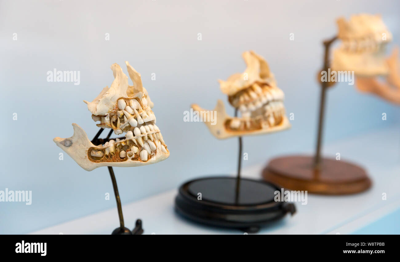 Medical models of human jaws on the stand Stock Photo - Alamy
