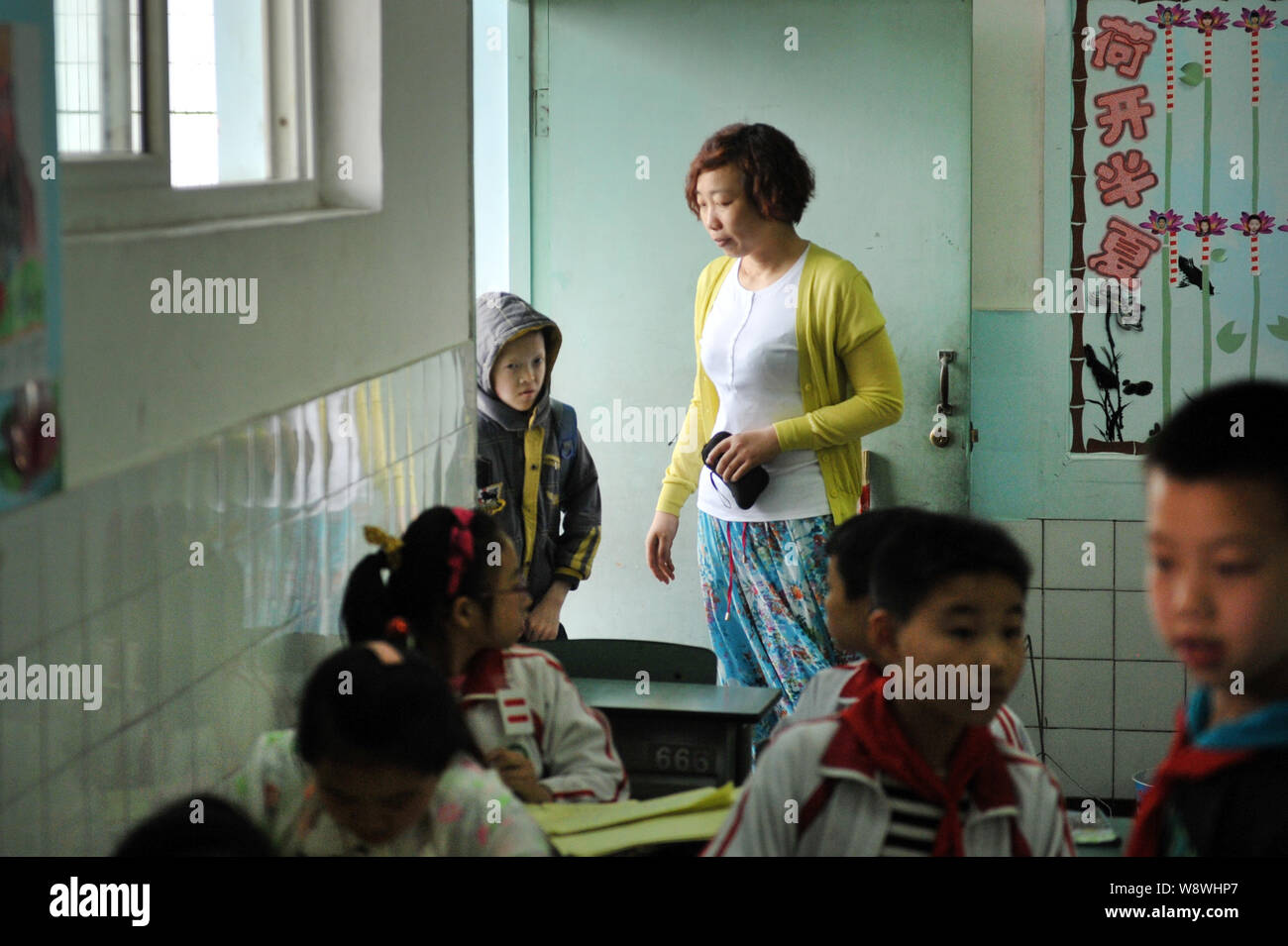 Liu Liangchen, center, who wraps himself up with preservative film because of a rare skin ...