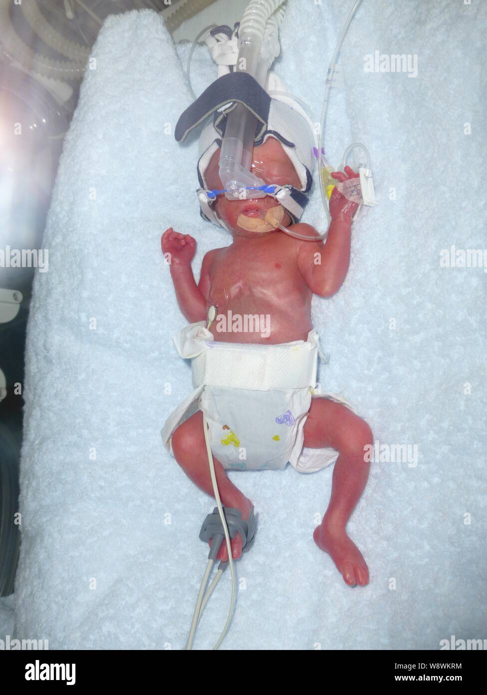 Icu intensive care unit hi-res stock photography and images - Alamy