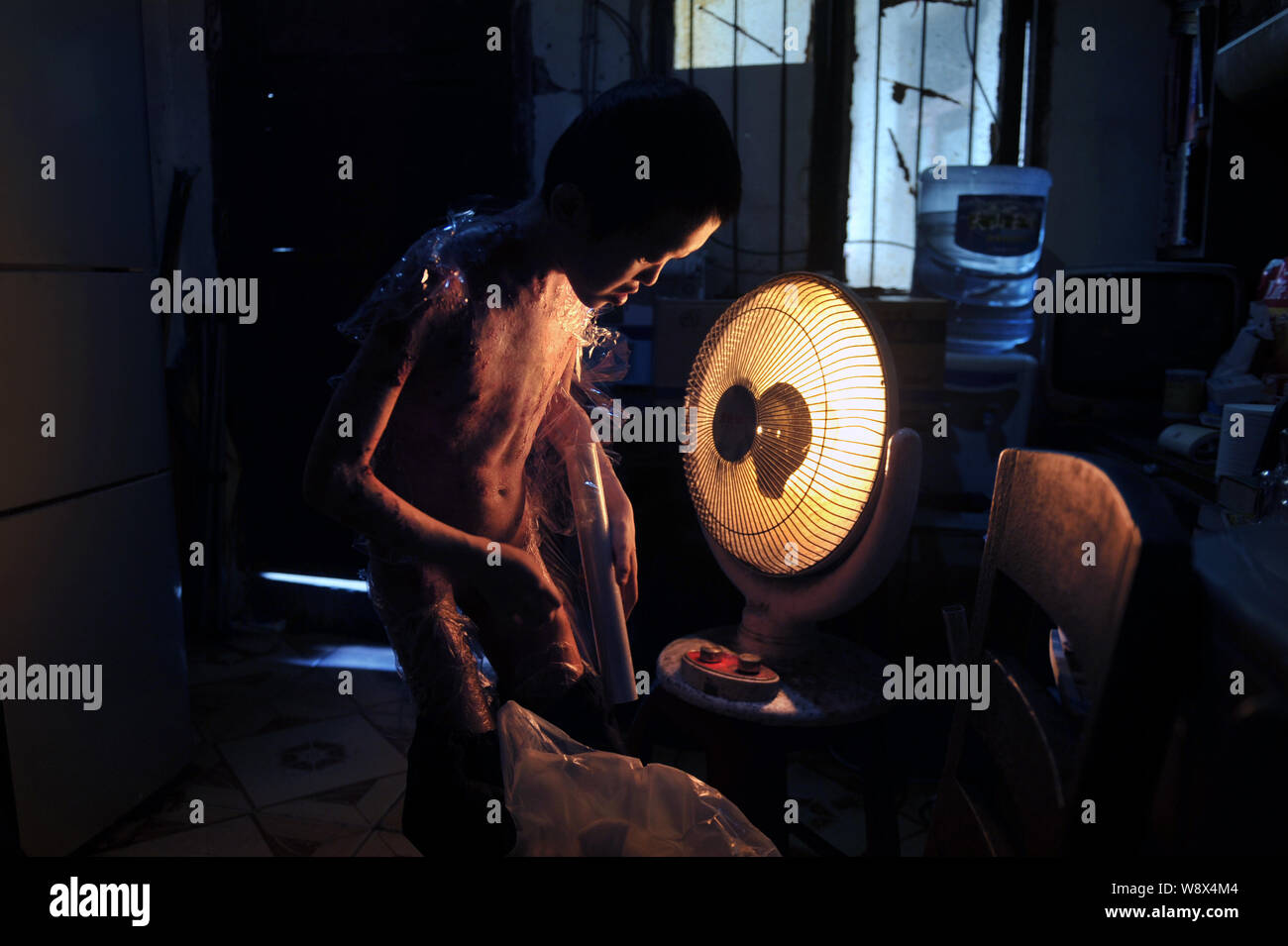 Liu Liangchen dries up his blood on the skin with a heater as he wraps himself up with ...