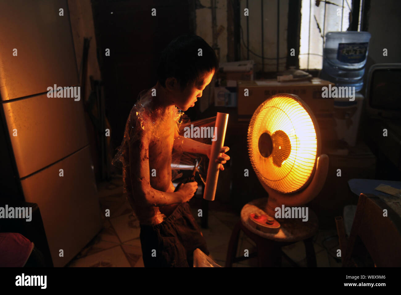 Liu Liangchen dries up his blood on the skin with a heater as he wraps himself up with ...