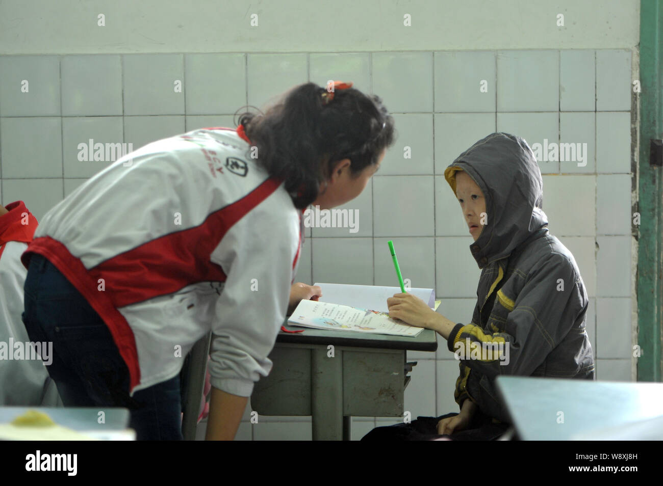 Liu Liangchen, right, who wraps himself up with preservative film because of a rare skin disease ...