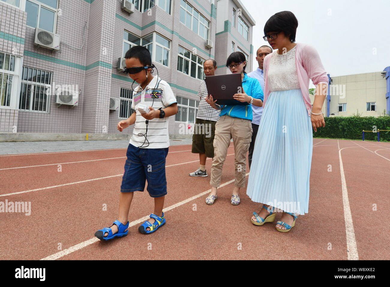 7-year-old Chinese boy Guo Bin, left, nicknamed Bin Bin, whose eyes ...