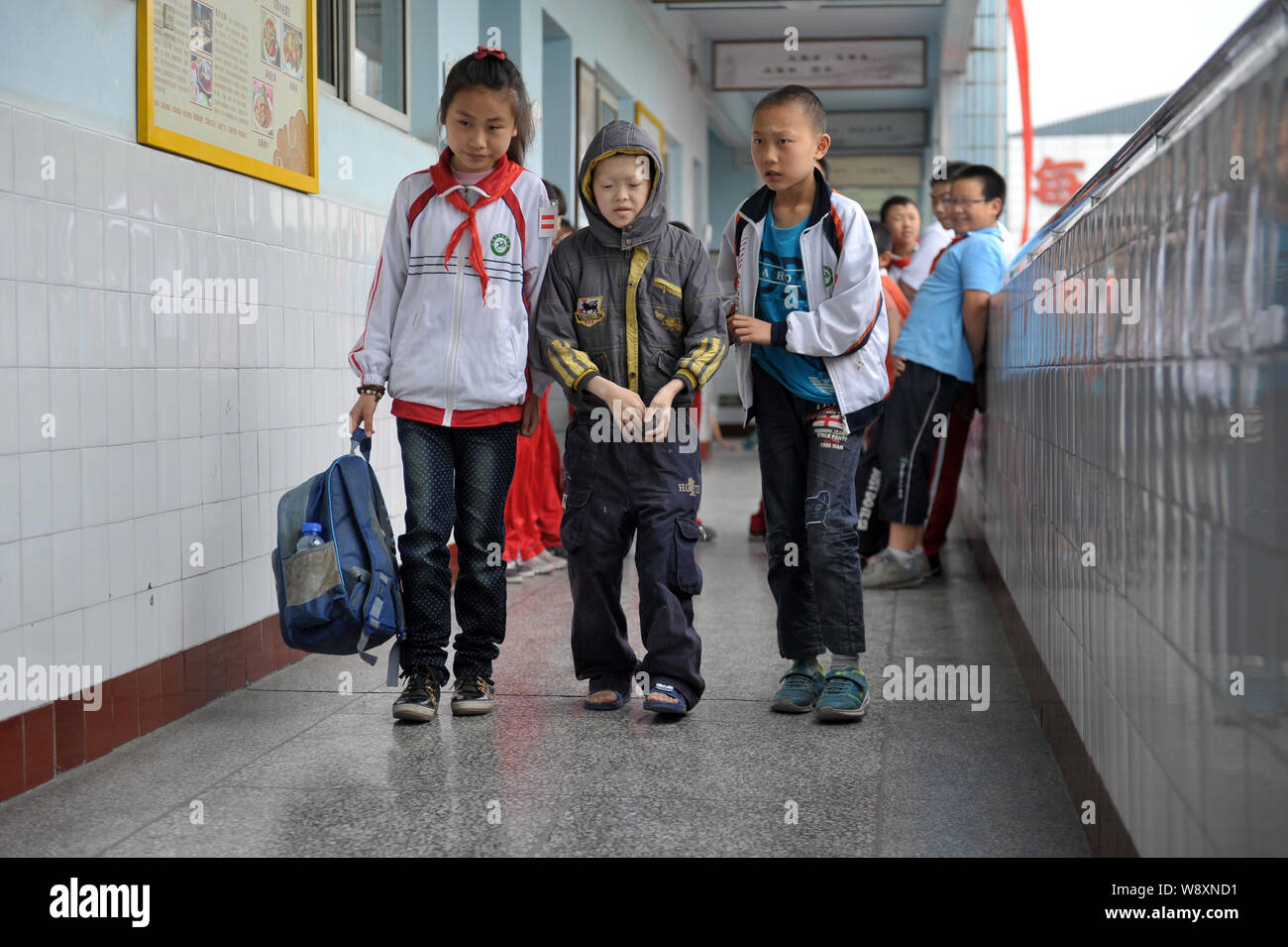 Liu Liangchen, center, who wraps himself up with preservative film because of a rare skin ...