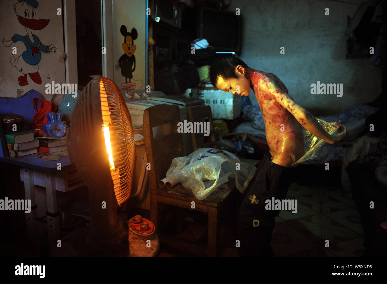 Liu Liangchen dries up his blood on the skin with a heater as he wraps himself up with ...