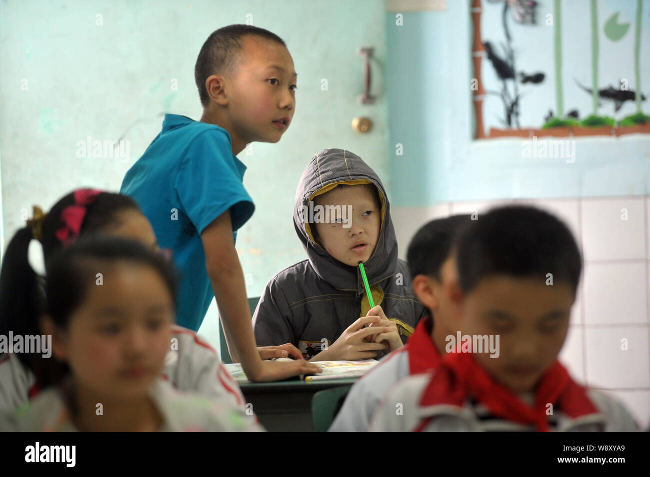 Liu Liangchen, back right, who wraps himself up with preservative film because of a rare skin ...