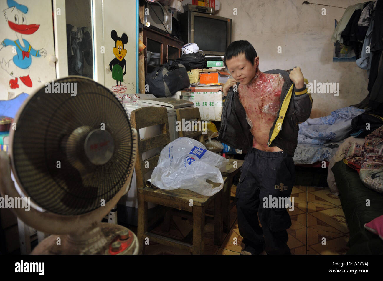 Liu Liangchen puts on clothes after wrapping himself up with preservative film because of a rare ...