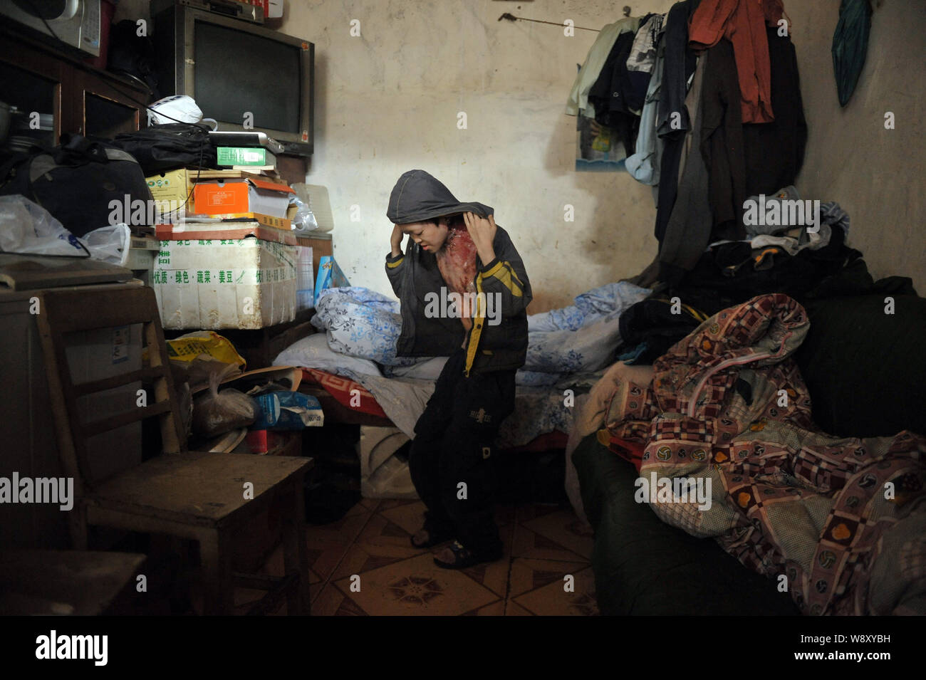 Liu Liangchen puts on clothes after wrapping himself up with preservative film because of a rare ...