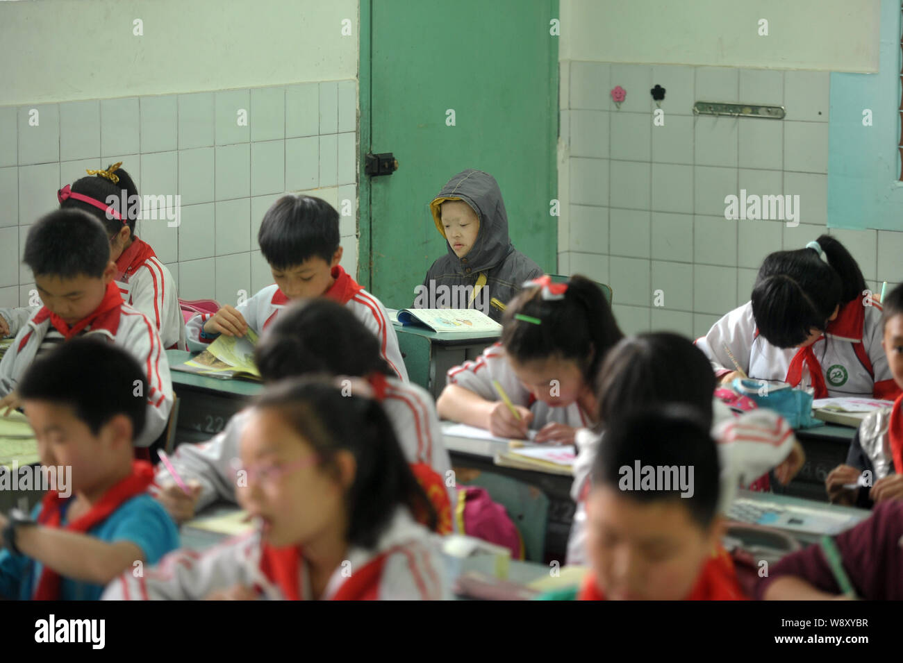 Liu Liangchen, back, who wraps himself up with preservative film because of a rare skin disease ...