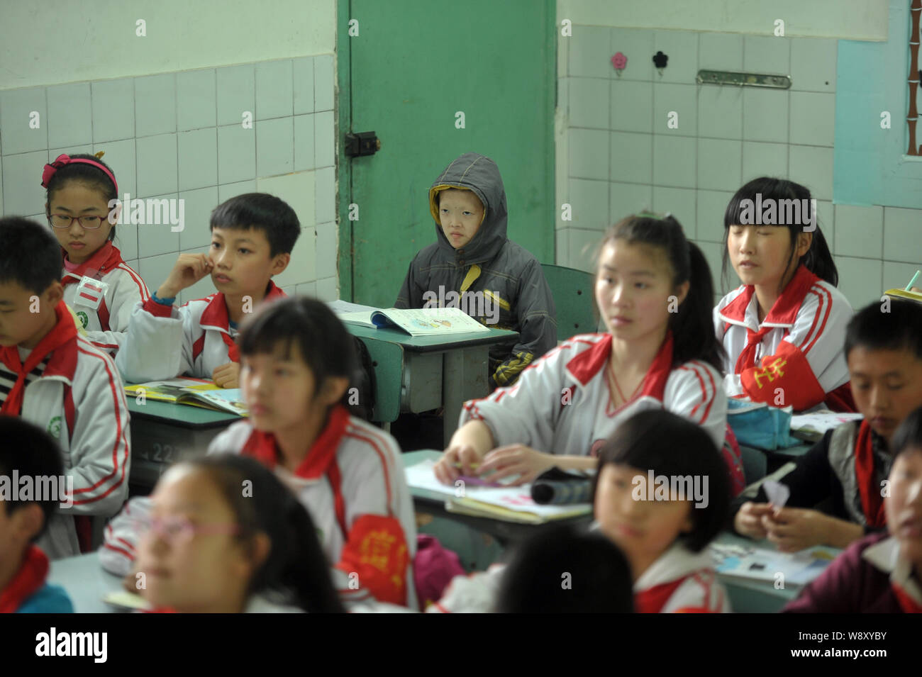 Liu Liangchen, back, who wraps himself up with preservative film because of a rare skin disease ...