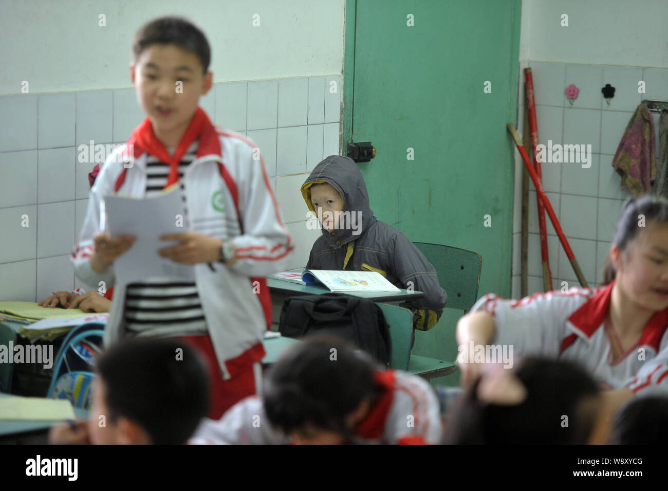 Liu Liangchen, back, who wraps himself up with preservative film because of a rare skin disease ...