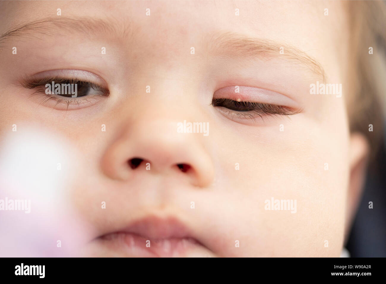 Child eyelid hi-res stock photography and images - Alamy
