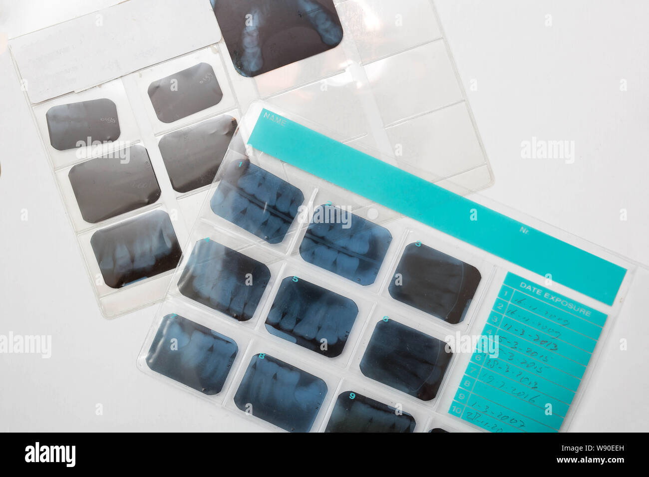 Diagnosis of diseases scan of the teeth. an orthopantomogram isolated ...