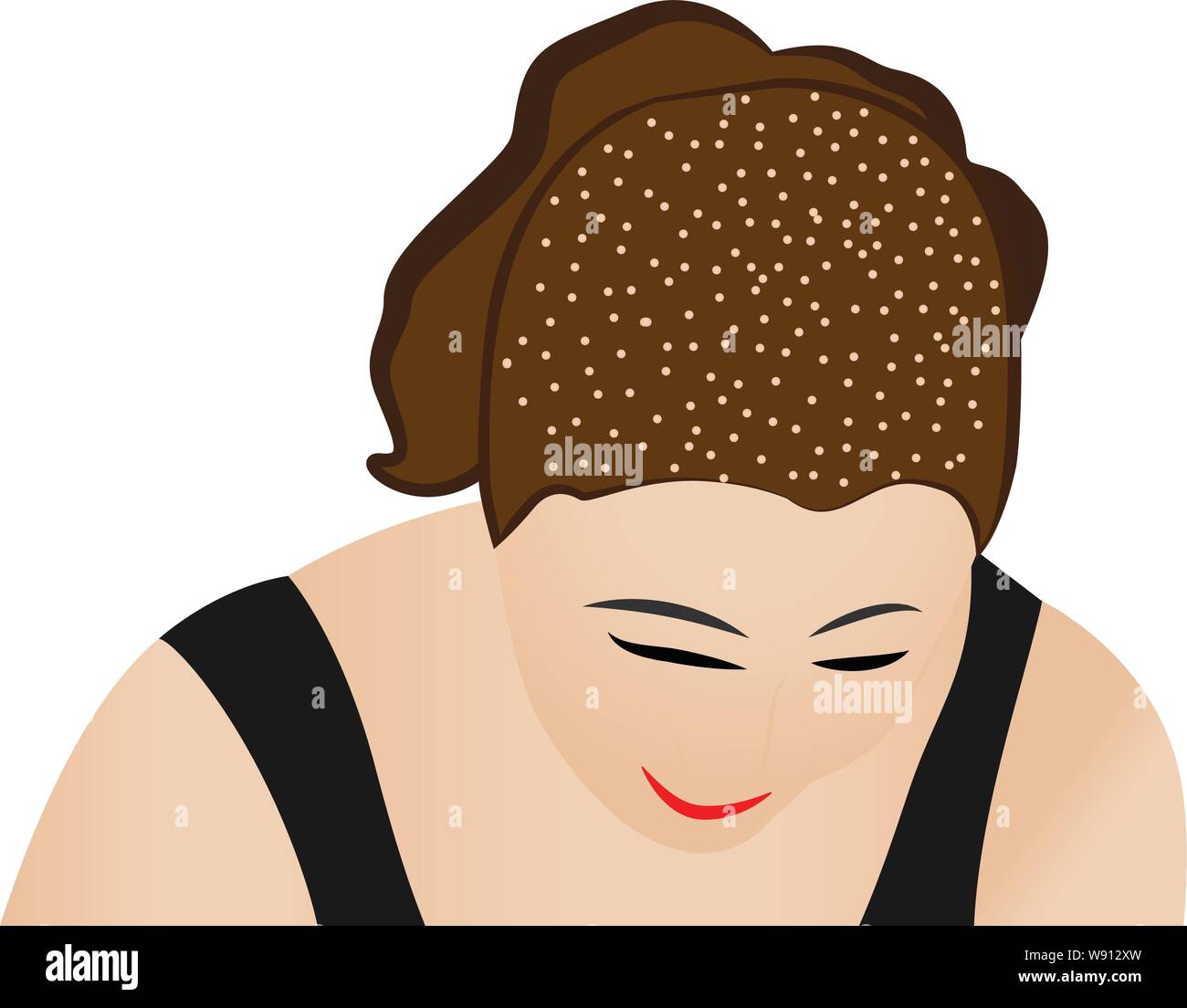A woman head full of dandruff vector illustration on a white background ...