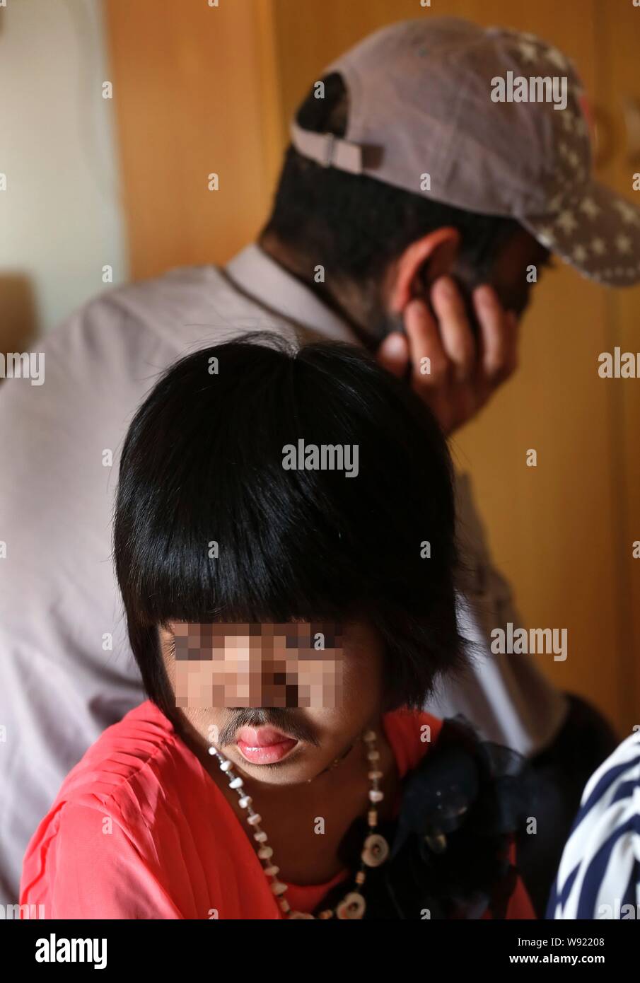 Young Chinese girl Ting Ting, front, who has a strong beard growing in ...