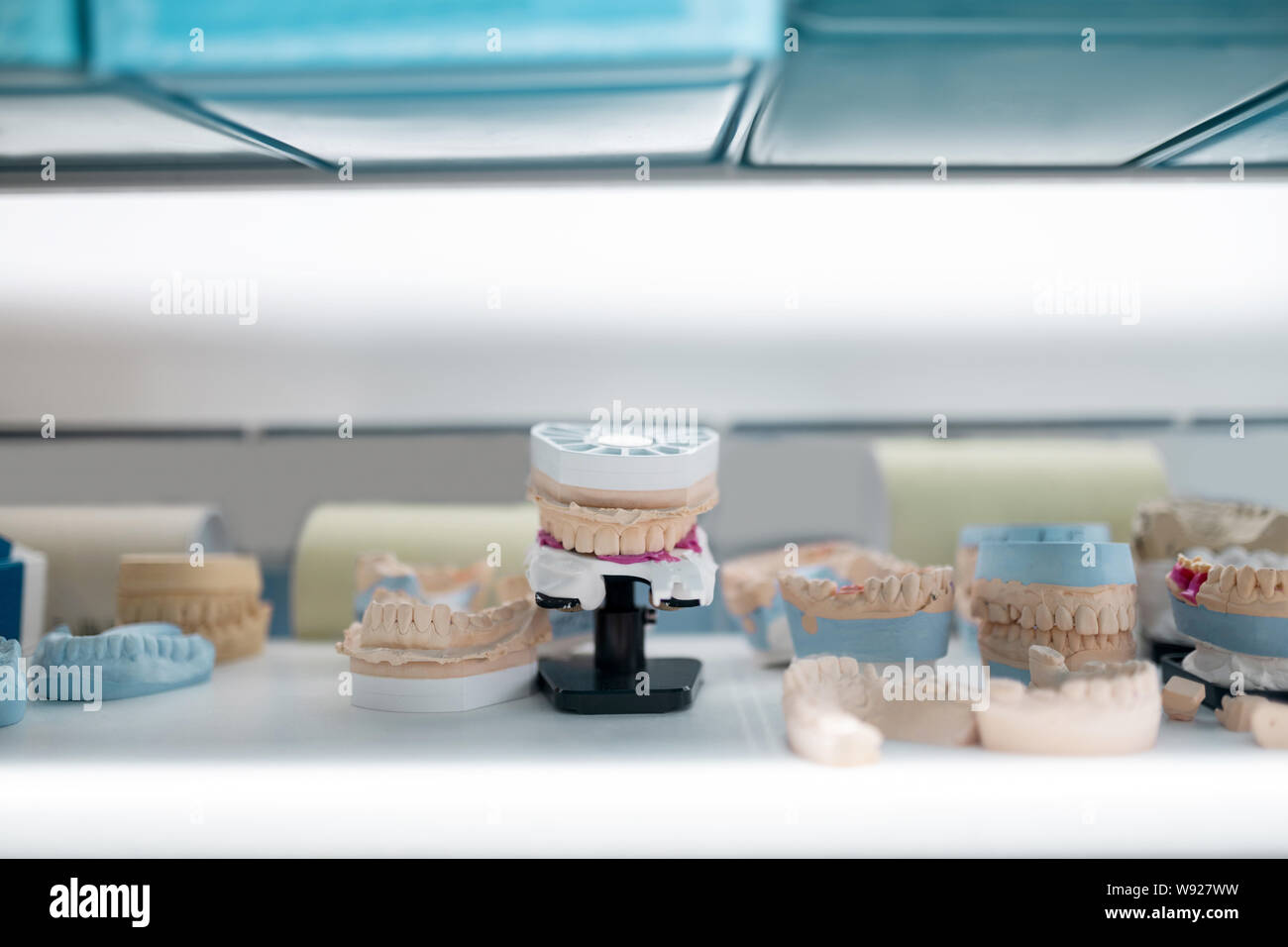 Cast models of different teeth standing on the table Stock Photo - Alamy