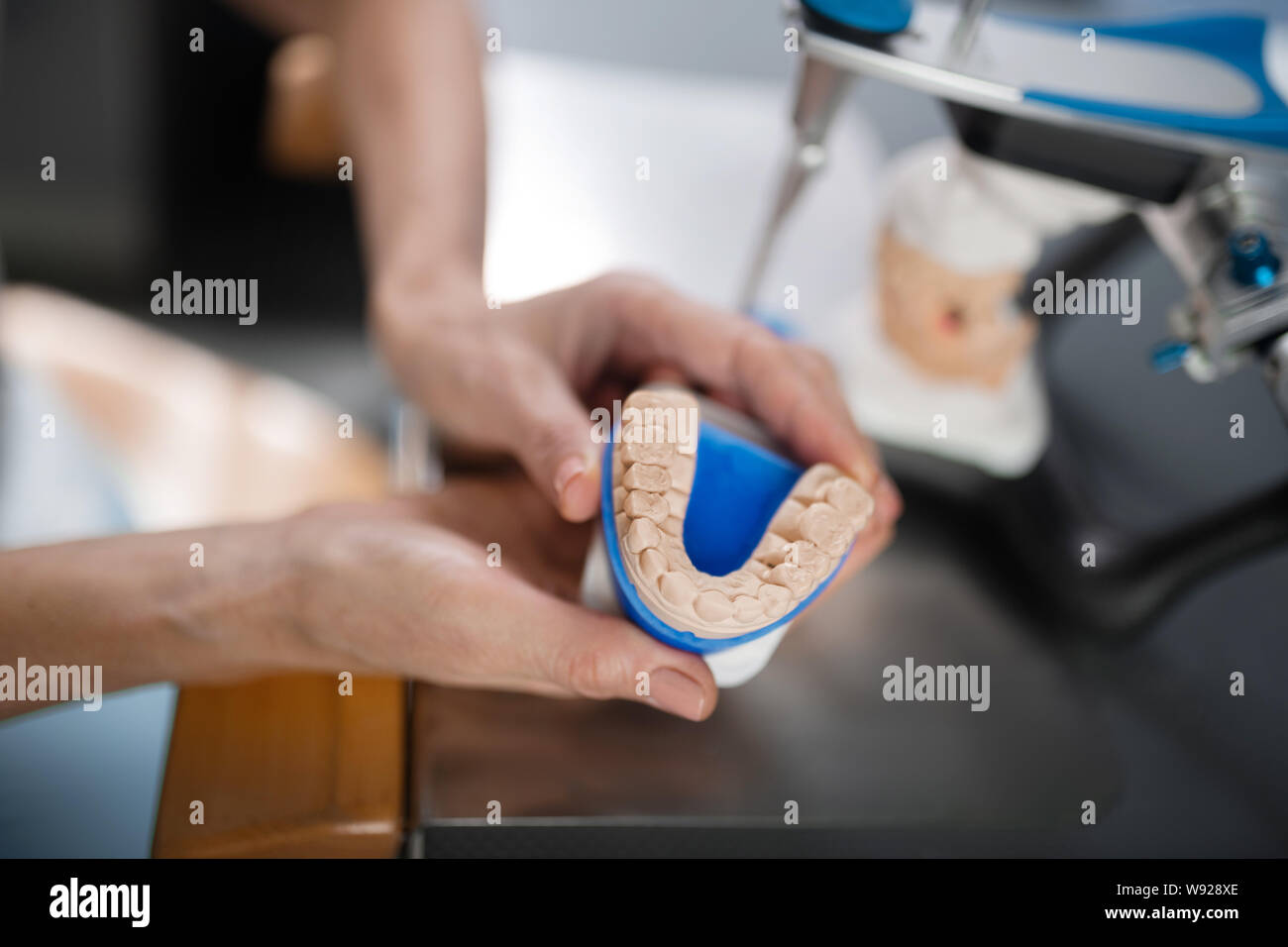 Cast model of patients teeth in hands of the dentist Stock Photo - Alamy