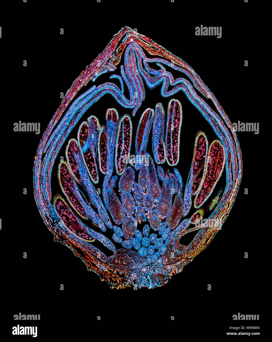 Buttercup, Ranunculus sp. flower head, LS. darkfield photomicrograph ...