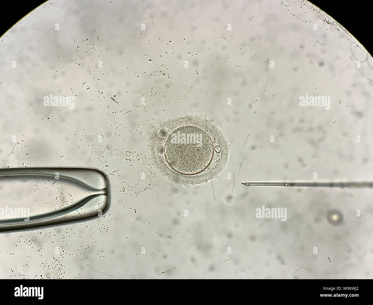 View through microscope at in vitro fertilization process Stock Photo ...