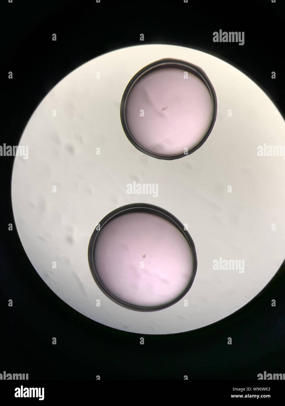 View through microscope at in vitro fertilization process Stock Photo ...