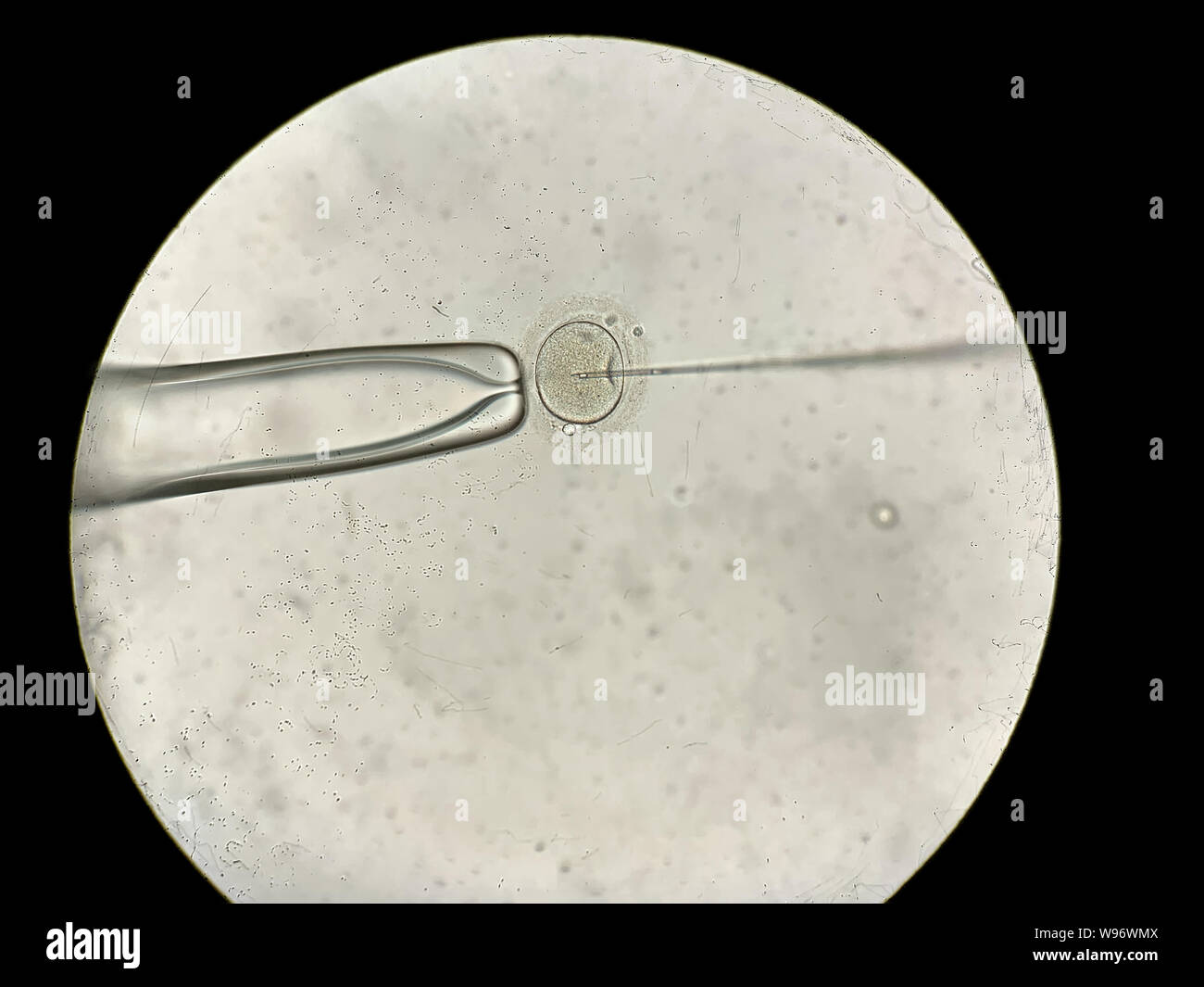 View through microscope at in vitro fertilization process Stock Photo ...