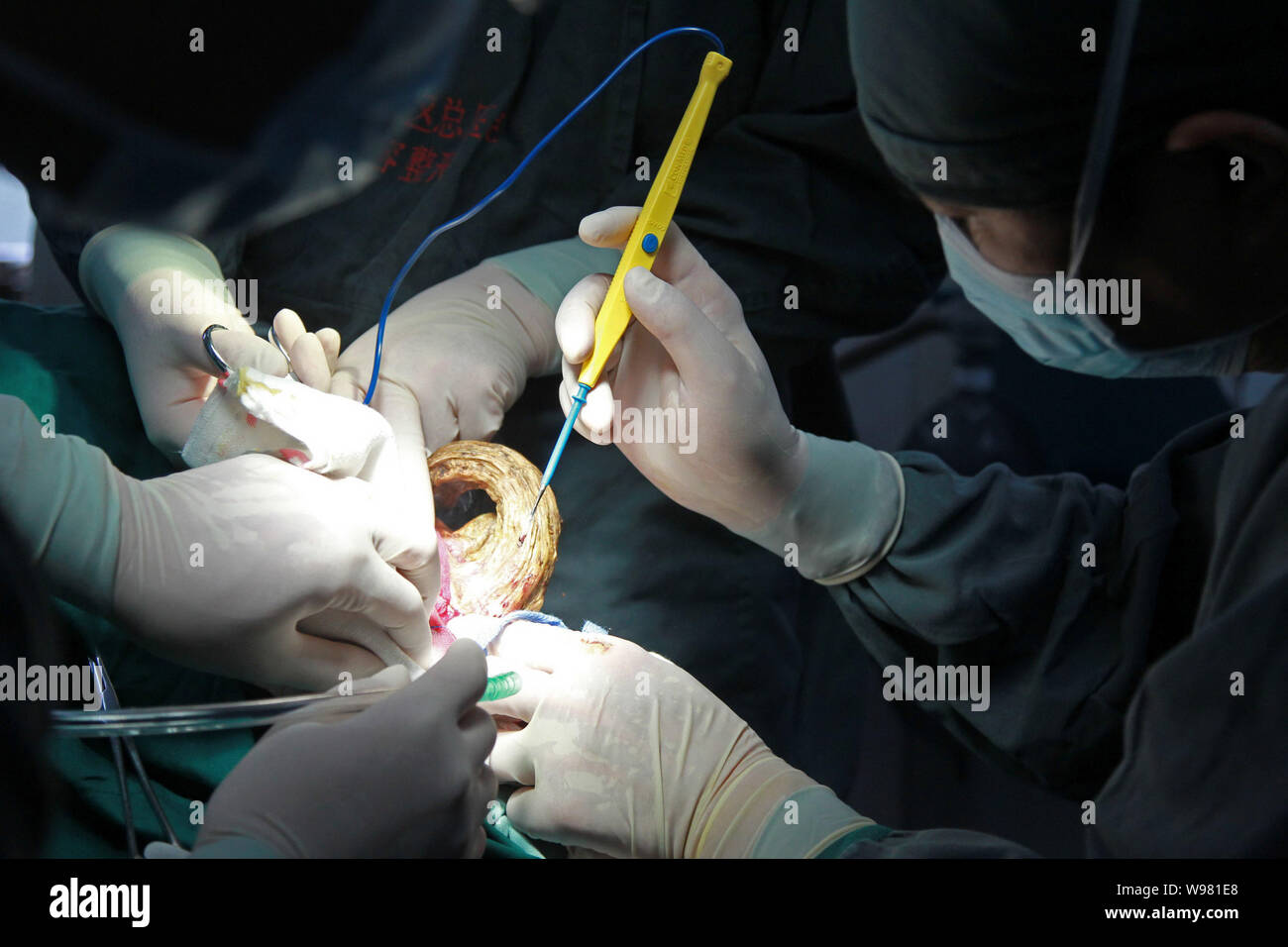Doctors are seen busy with operating on the woman at Beijing Military ...
