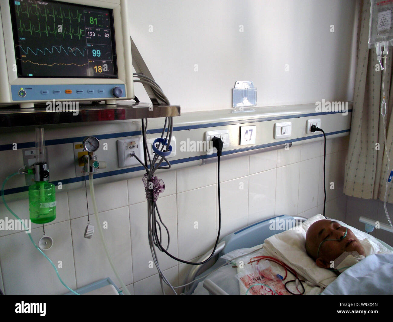 Li Fu rests in the bed after a surgery at a hospital in Yuxi city ...