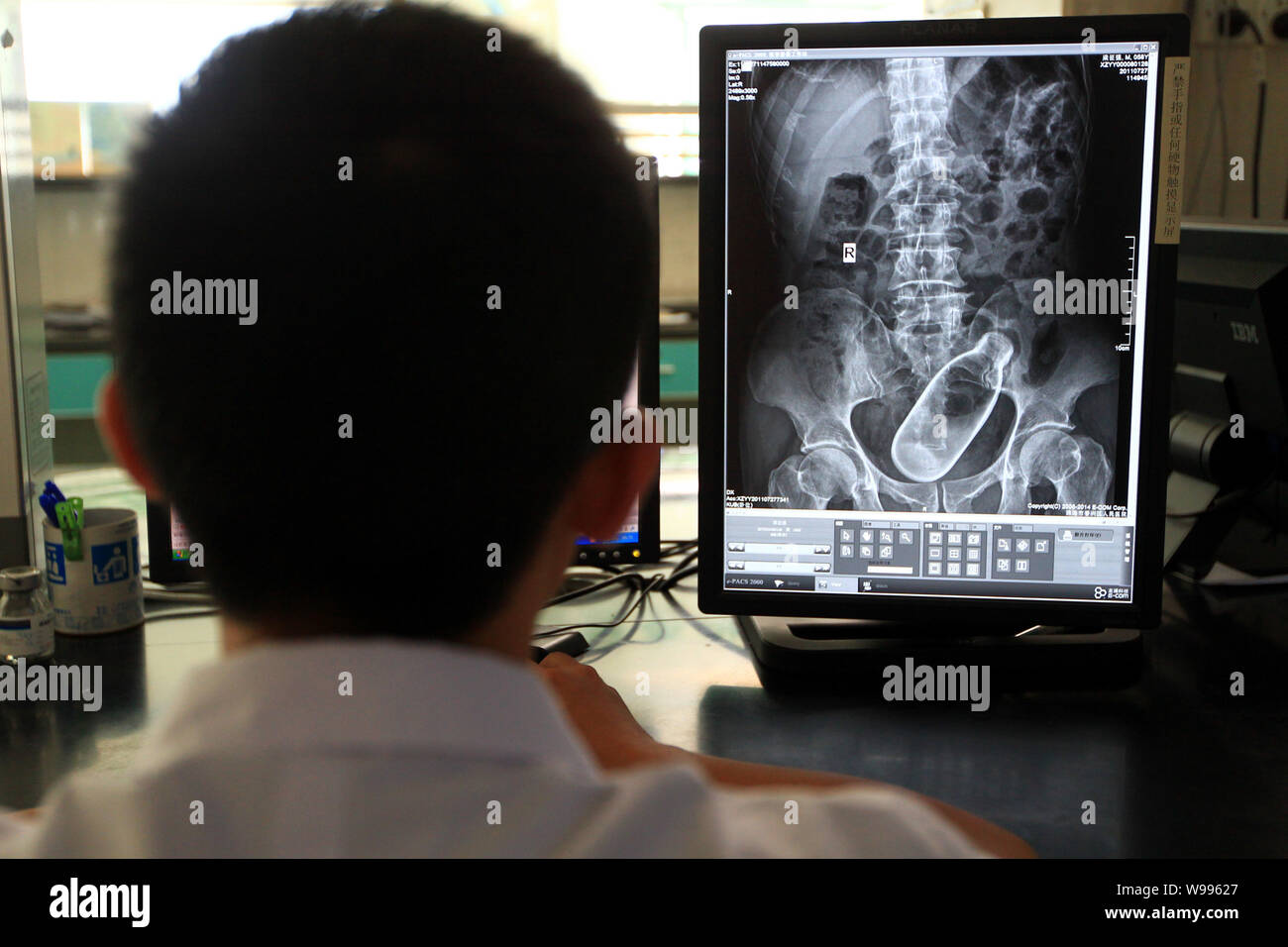 X ray studies hi-res stock photography and images - Alamy