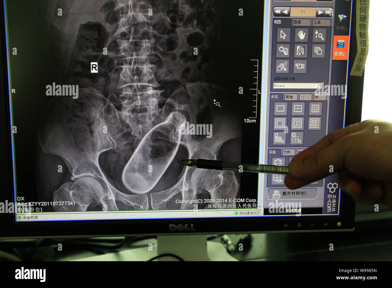 X ray studies hi-res stock photography and images - Alamy