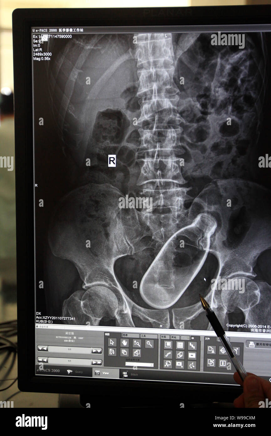 X ray studies hi-res stock photography and images - Alamy